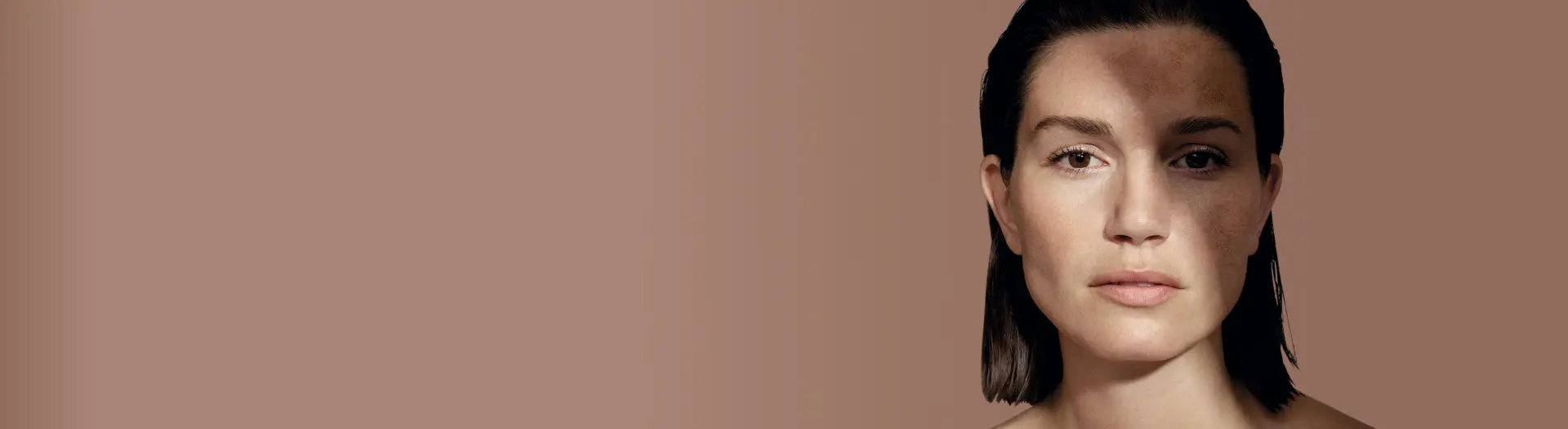 Abordaje 360° hiperpigmentación | Axtetic.MX